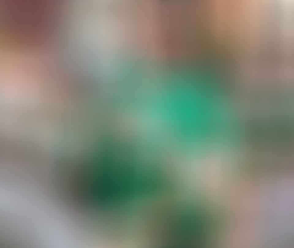 Understanding Anisocoria: Causes and Evaluations of Unequal Pupil Sizes ...